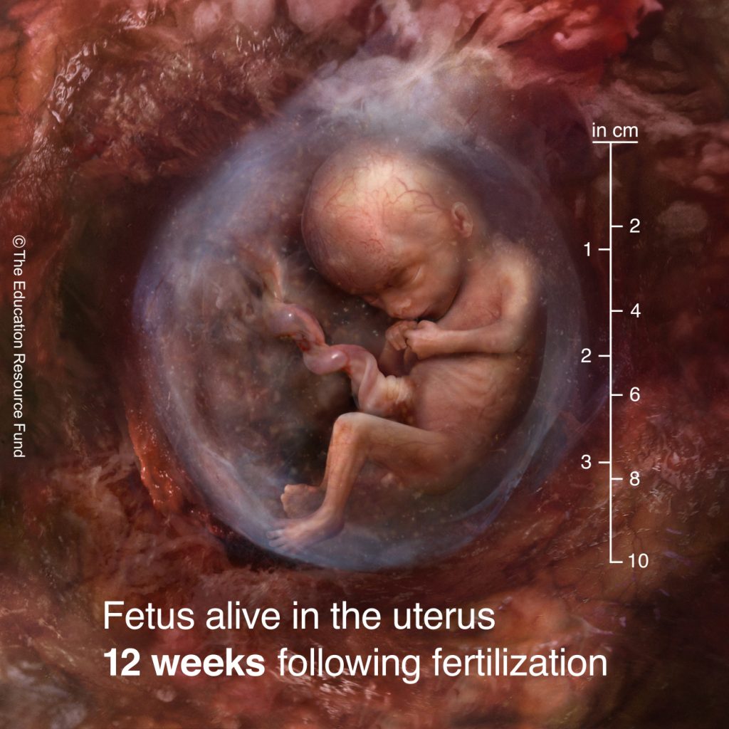 Embryo and Fetus Images - Education Resource Fund