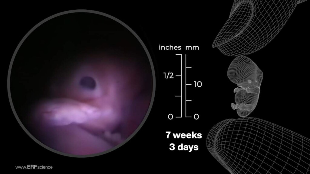 The Science of Life Before Birth - Education Resource Fund